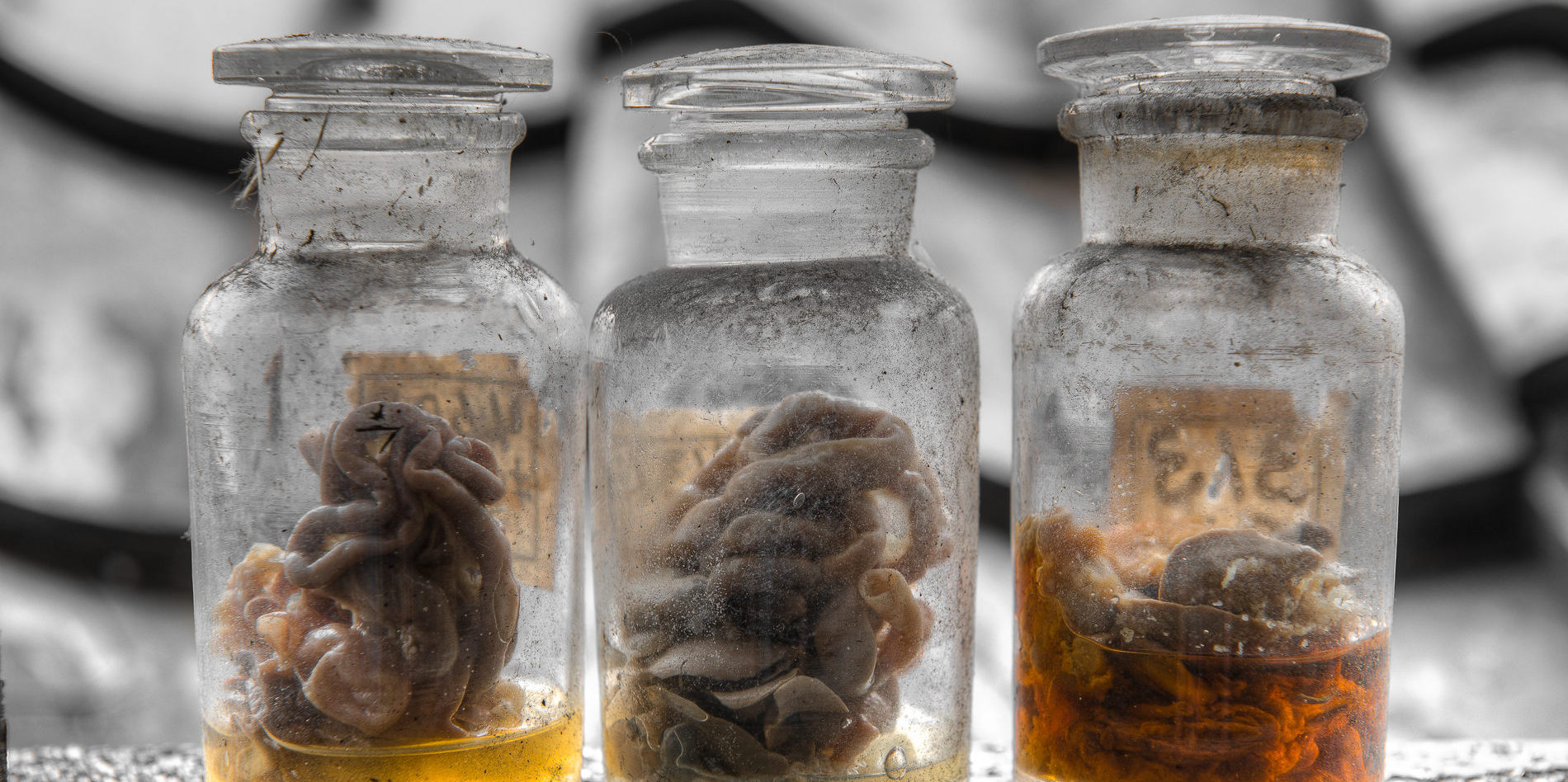 Au musée des pathologies, tout baigne... dans le formol | StreetPress